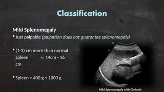 splenomegaly radiology -180319023541.ppt