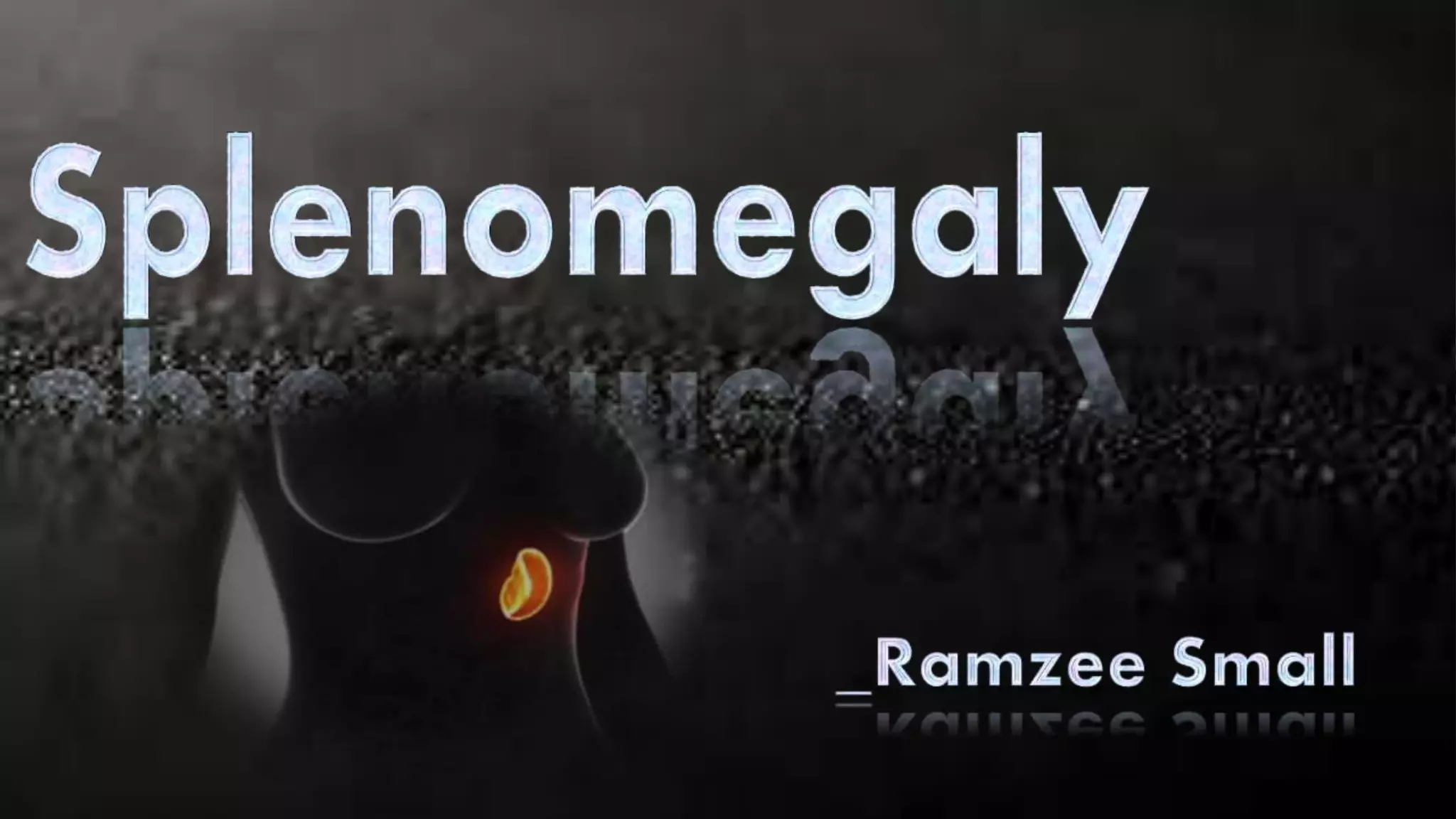 Splenomegaly | PPTX