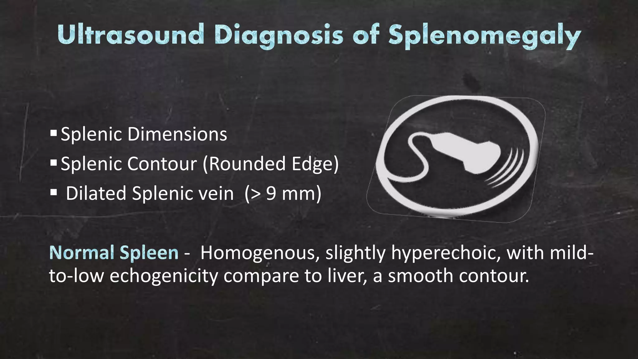 Splenomegaly | PPTX