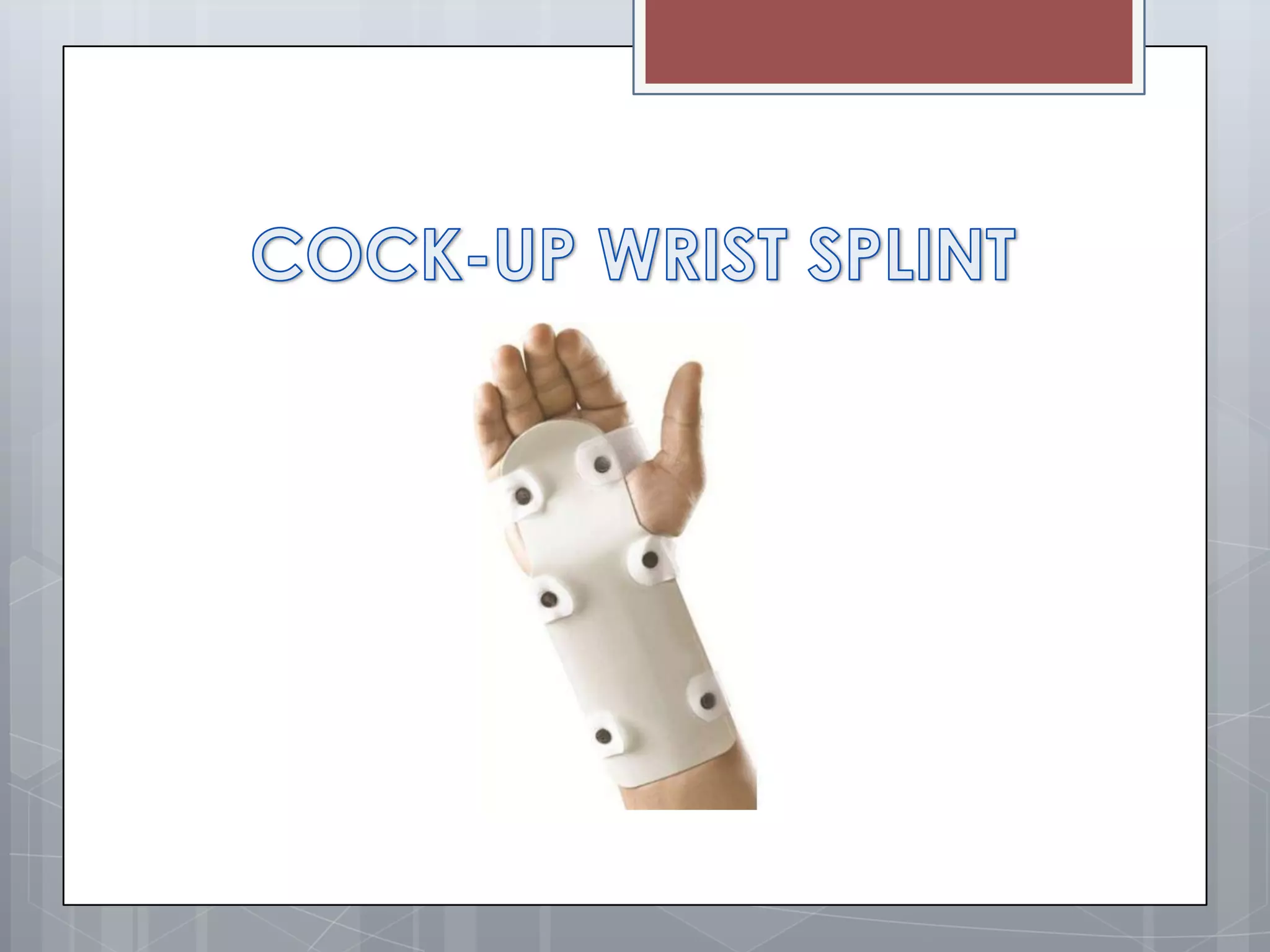 Splint and tractions | PPTX