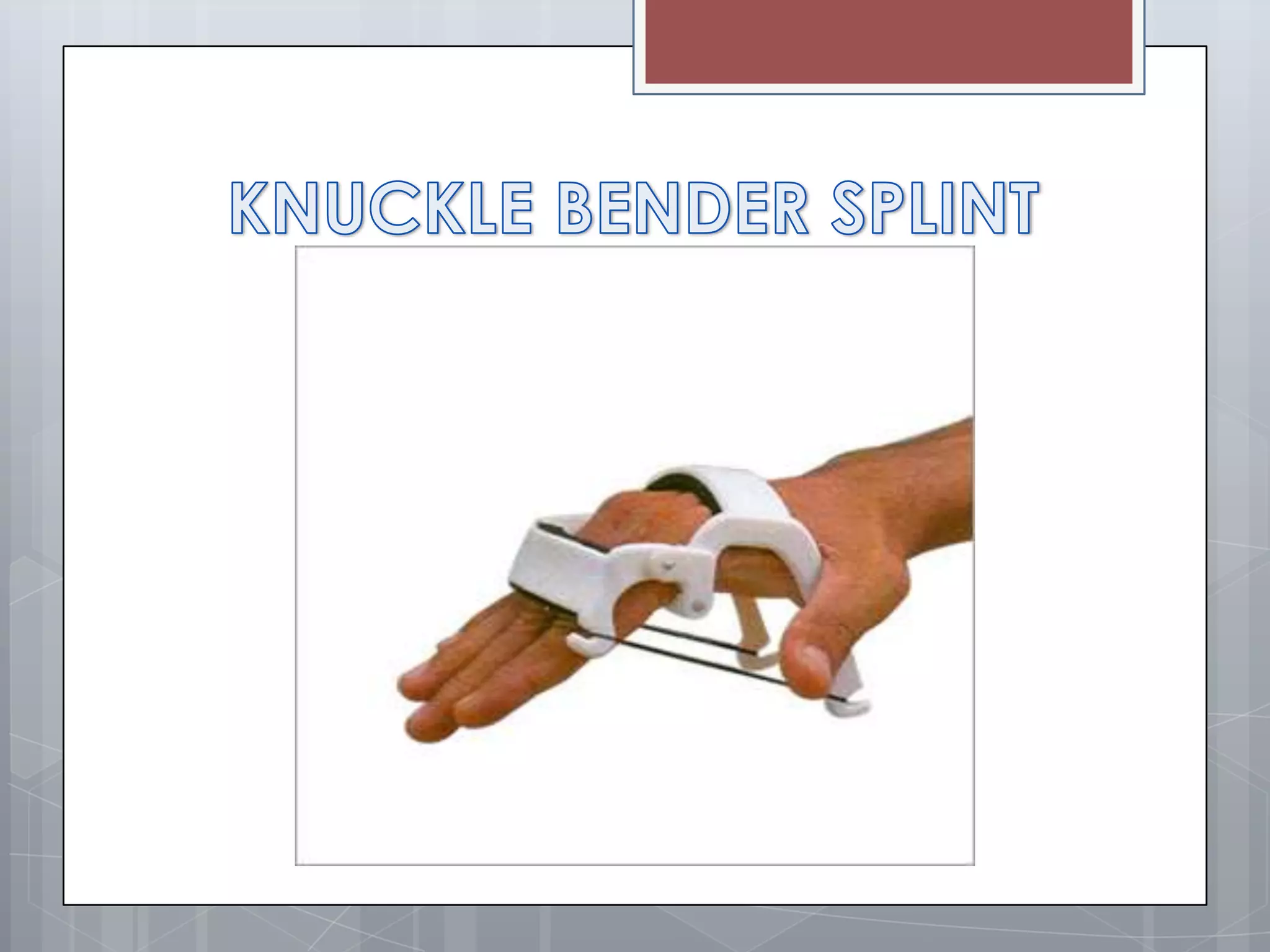 Splint and tractions | PPTX