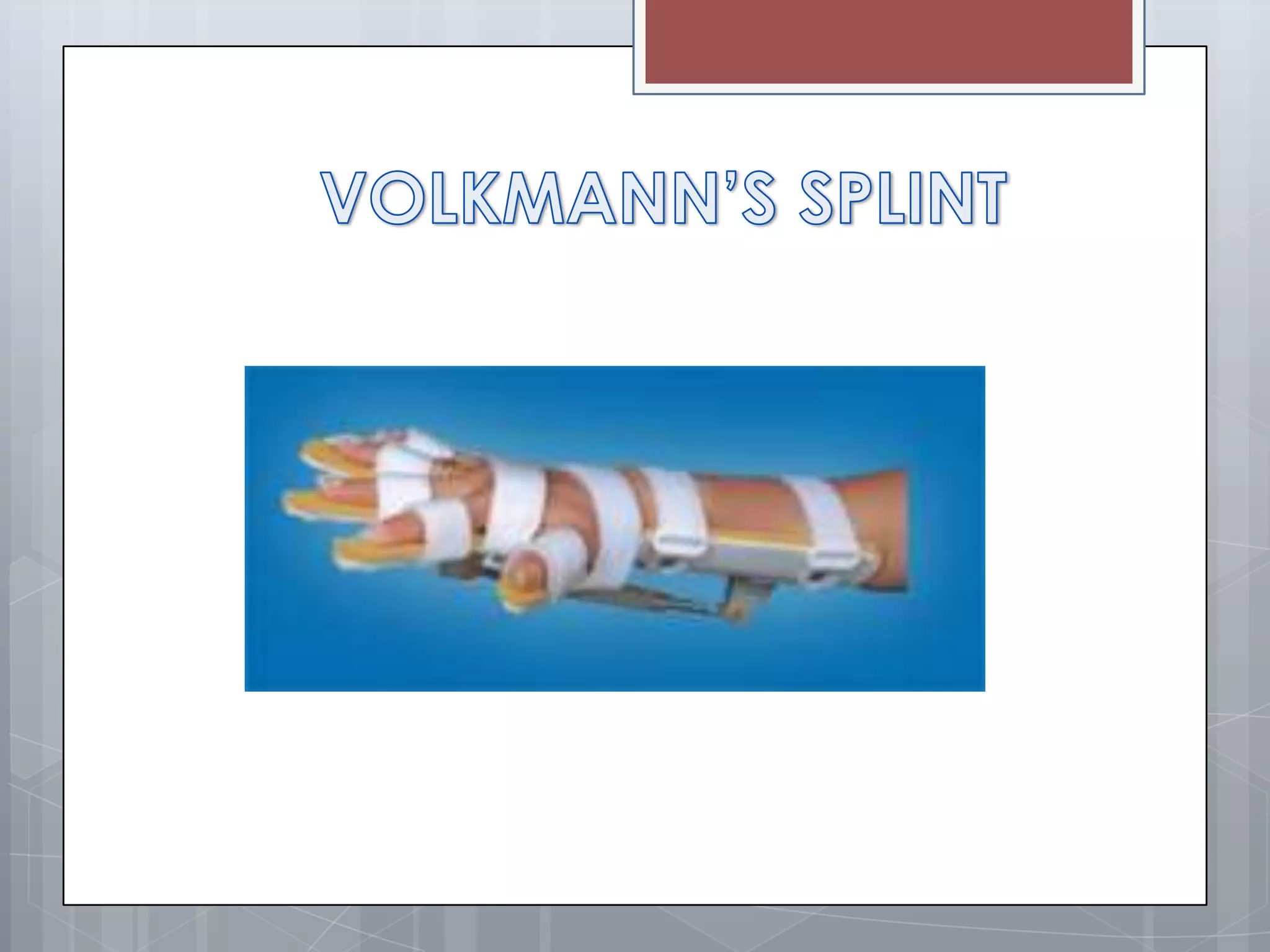 Splint and tractions | PPTX