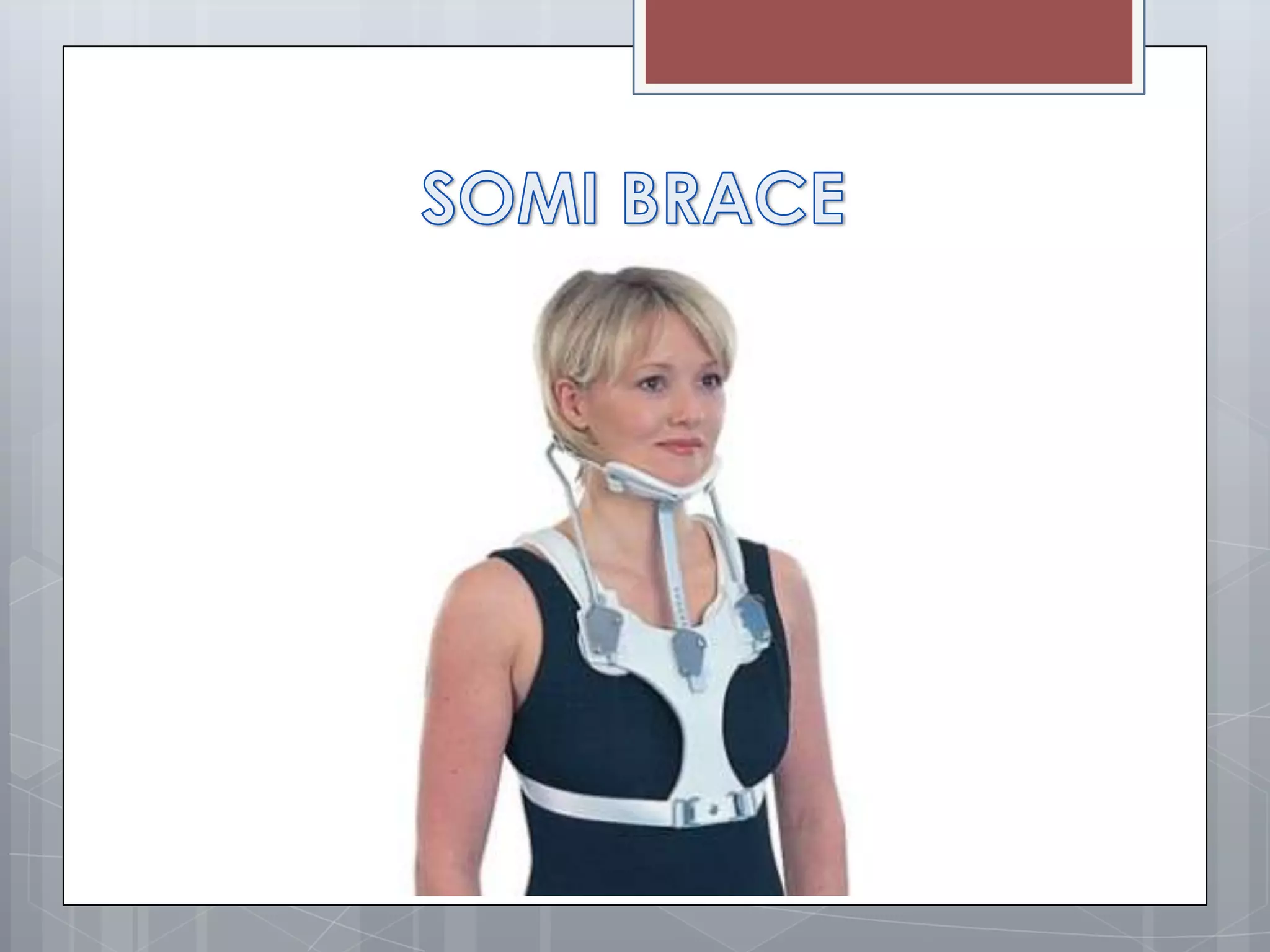 Splint and tractions | PPTX