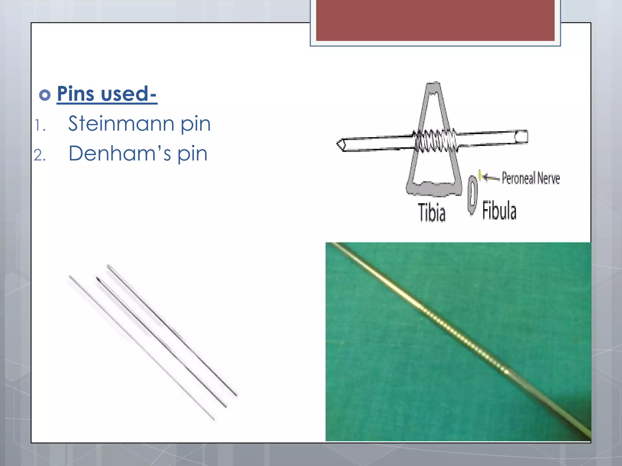 Splint and tractions | PPTX
