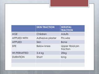 Splint and tractions | PPTX