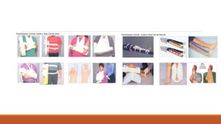 Splint and bandage | PPTX