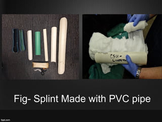 Indications and Limitations of Splint and cast used for Bovine ...