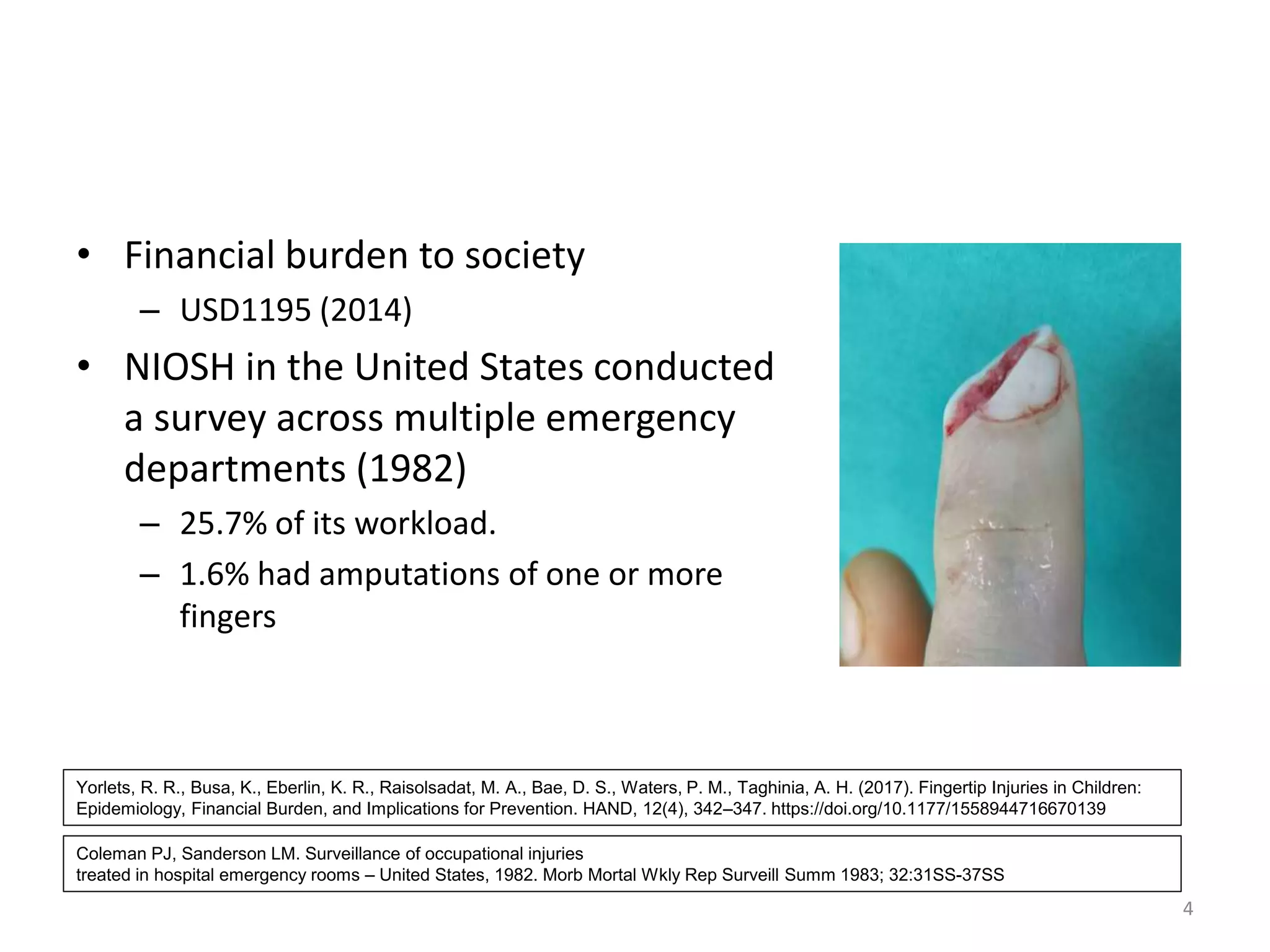 Finger tip injuries | PPTX