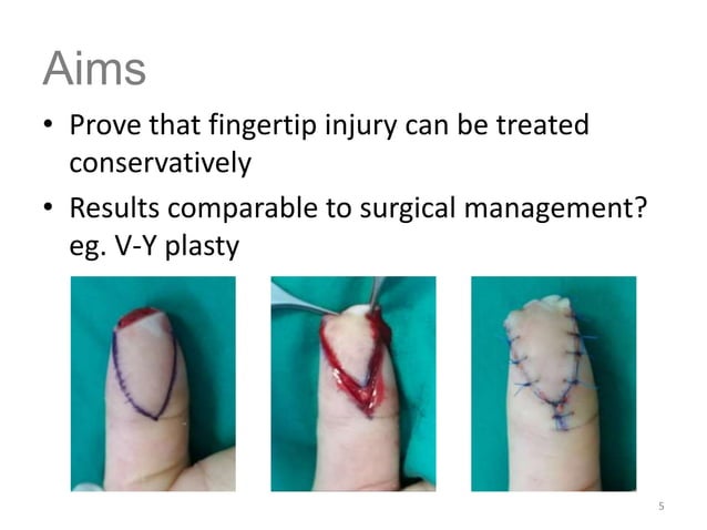 Finger tip injuries | PPTX | Physical Therapy | Wellness