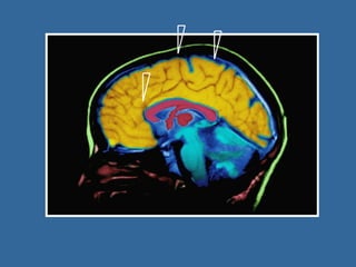 Splinter Negotiation Technique | PPT