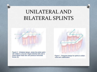 Splinting | PPTX