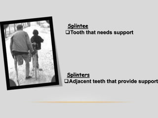 Splinting of teeth in periodontics | PPTX
