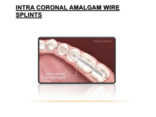 Splinting of teeth in periodontics | PPTX