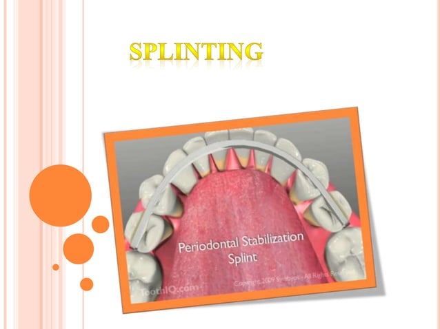 Splinting | PPTX | Dental Health | Diseases and Conditions