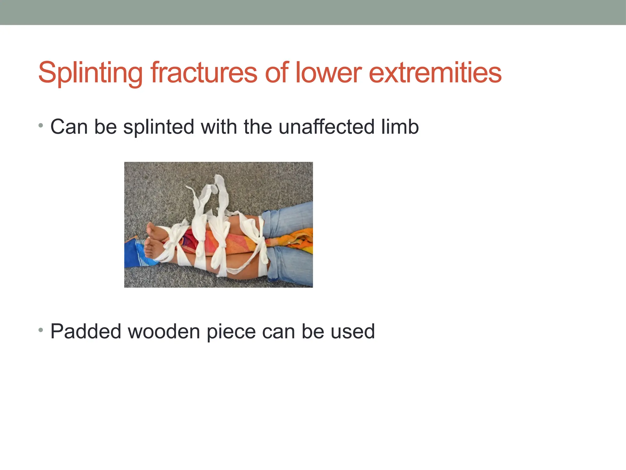 The technique for the proper application of splint. of | PPTX