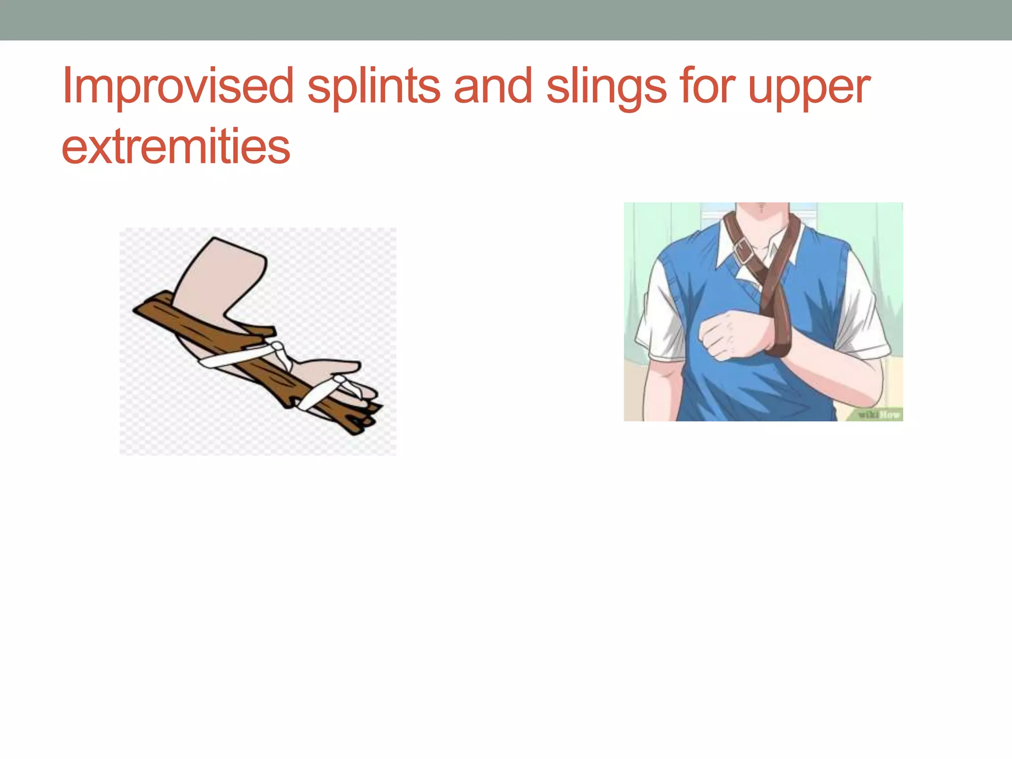 Splinting in first aid | PPTX