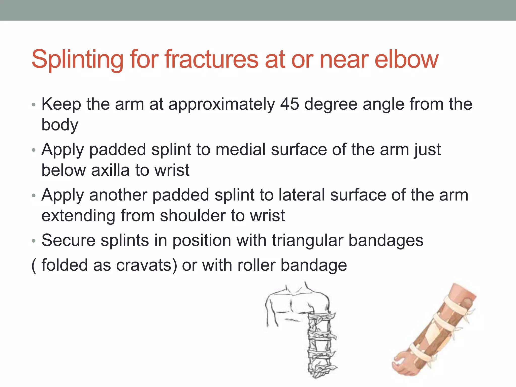 Splinting in first aid | PPTX