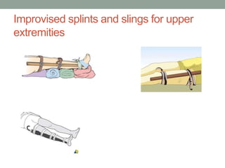 Splinting in first aid | PPTX