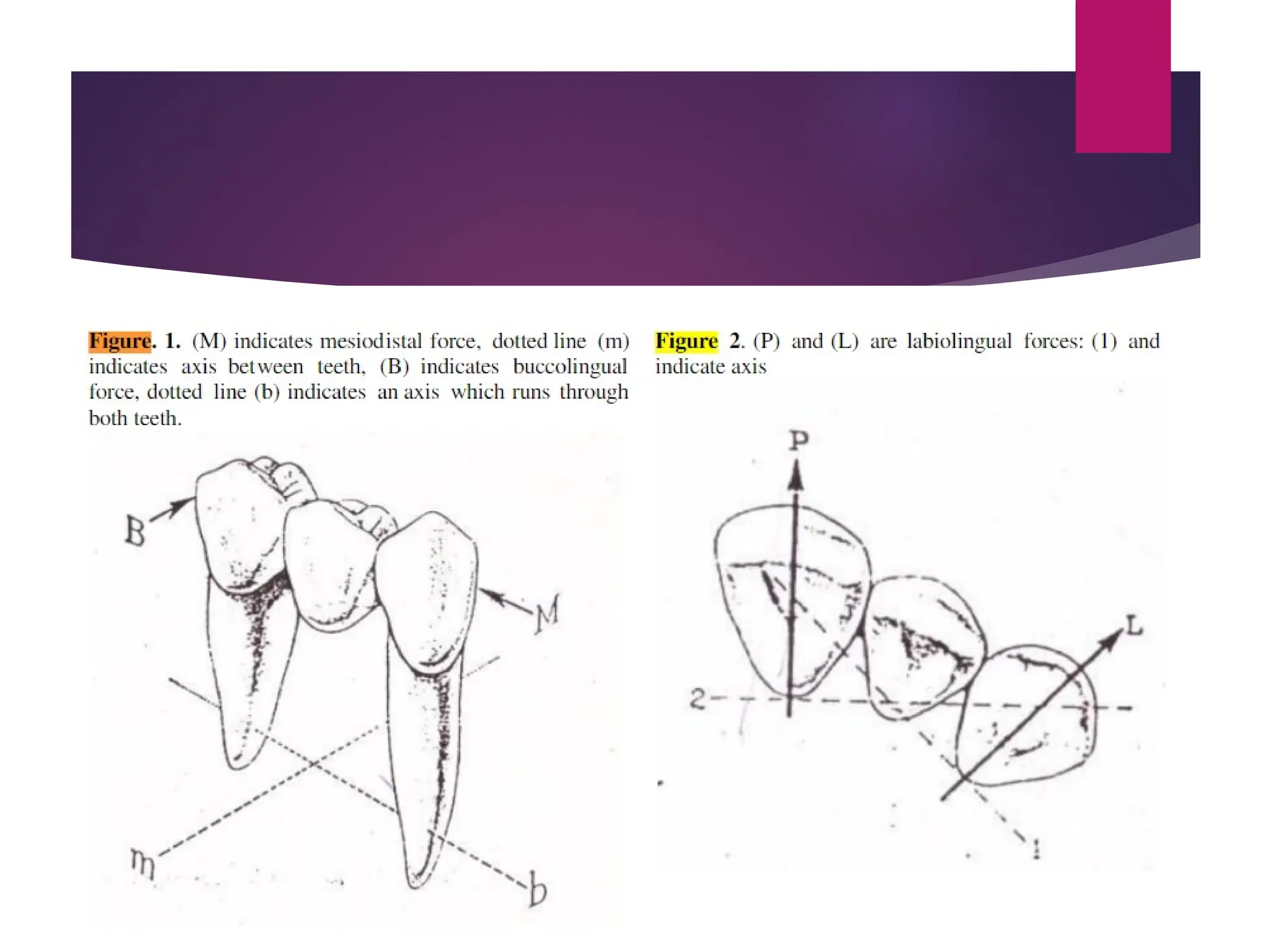 Splinting procedure and steps in dentistry. | PPT