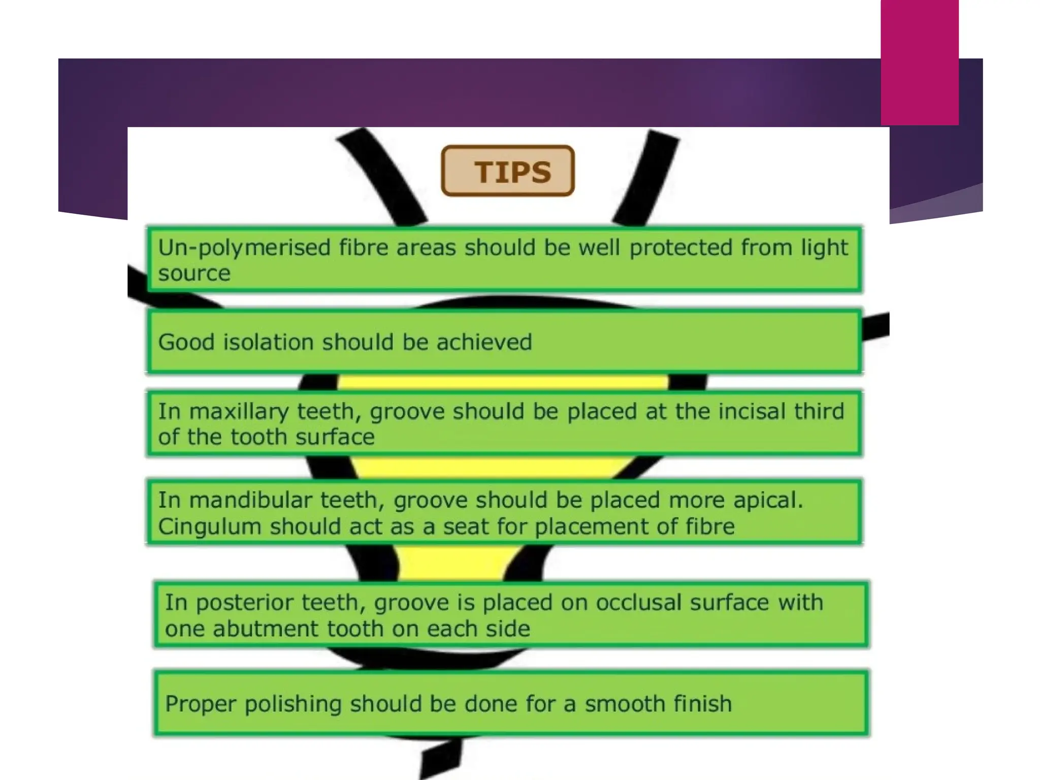 Splinting procedure and steps in dentistry. | PPT