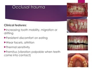 Splinting procedure and steps in dentistry. | PPT