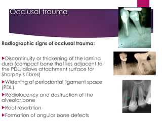 Splinting procedure and steps in dentistry. | PPT