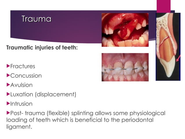 Splinting procedure and steps in dentistry. | PPT | Dental Health ...