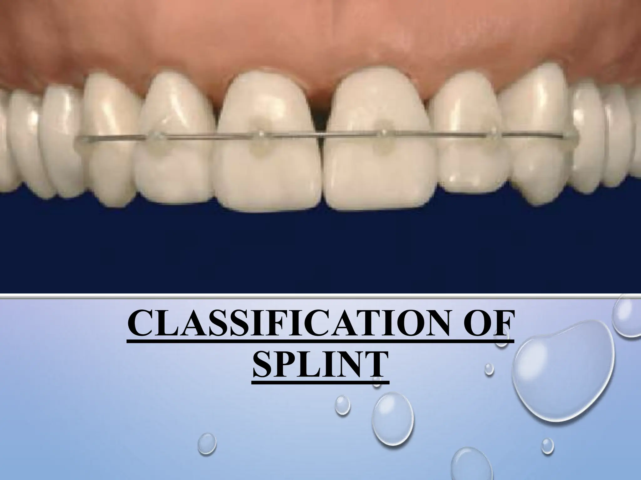 SPLINTING-MATERIALS AND TECHNIQUES final.pptx