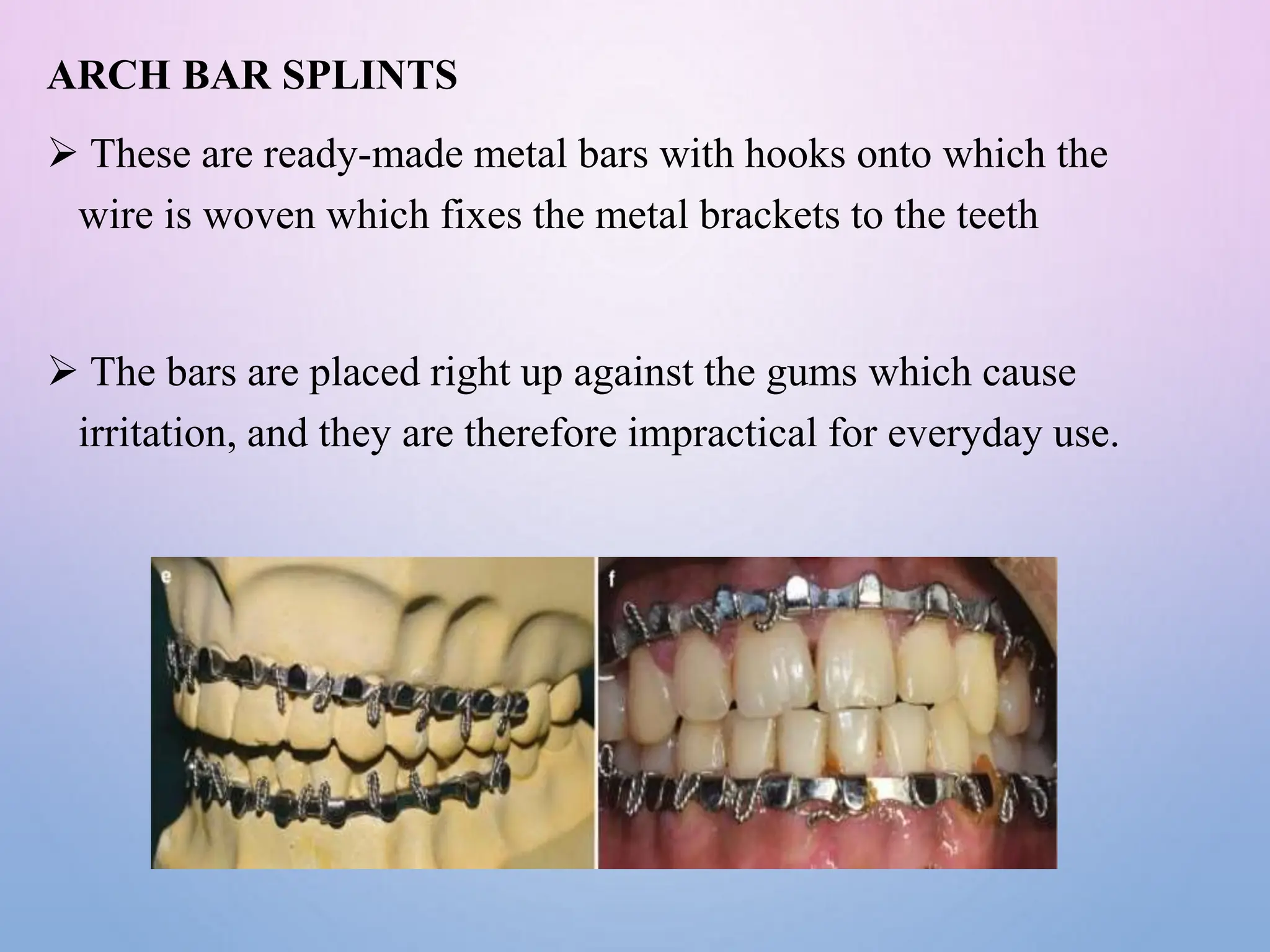 SPLINTING-MATERIALS AND TECHNIQUES final.pptx