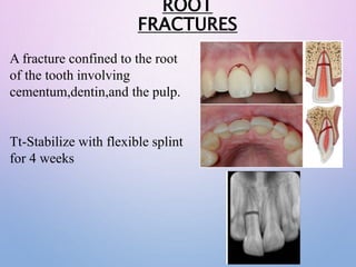 SPLINTING-MATERIALS AND TECHNIQUES final.pptx