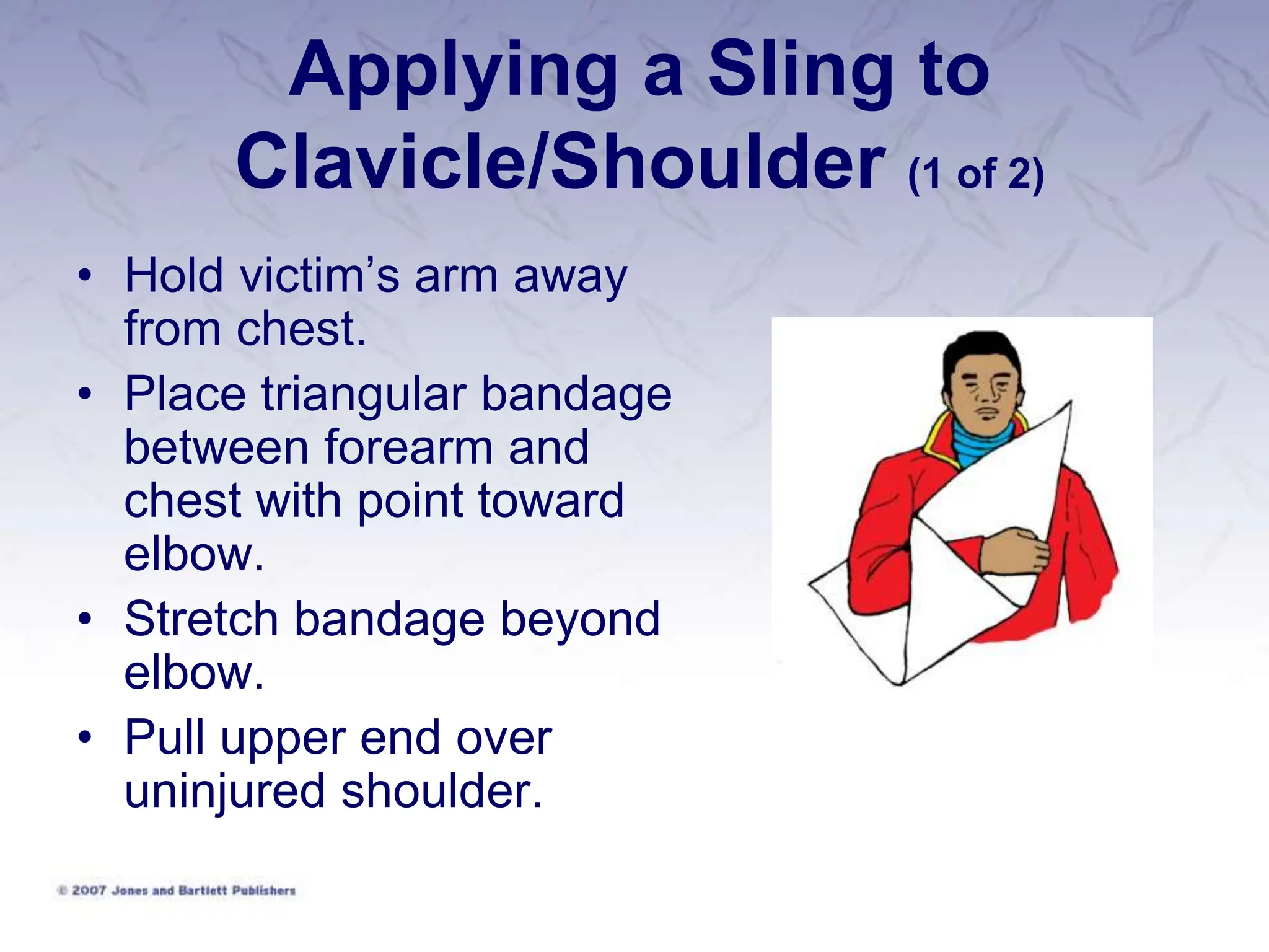 Splinting #6.ppt