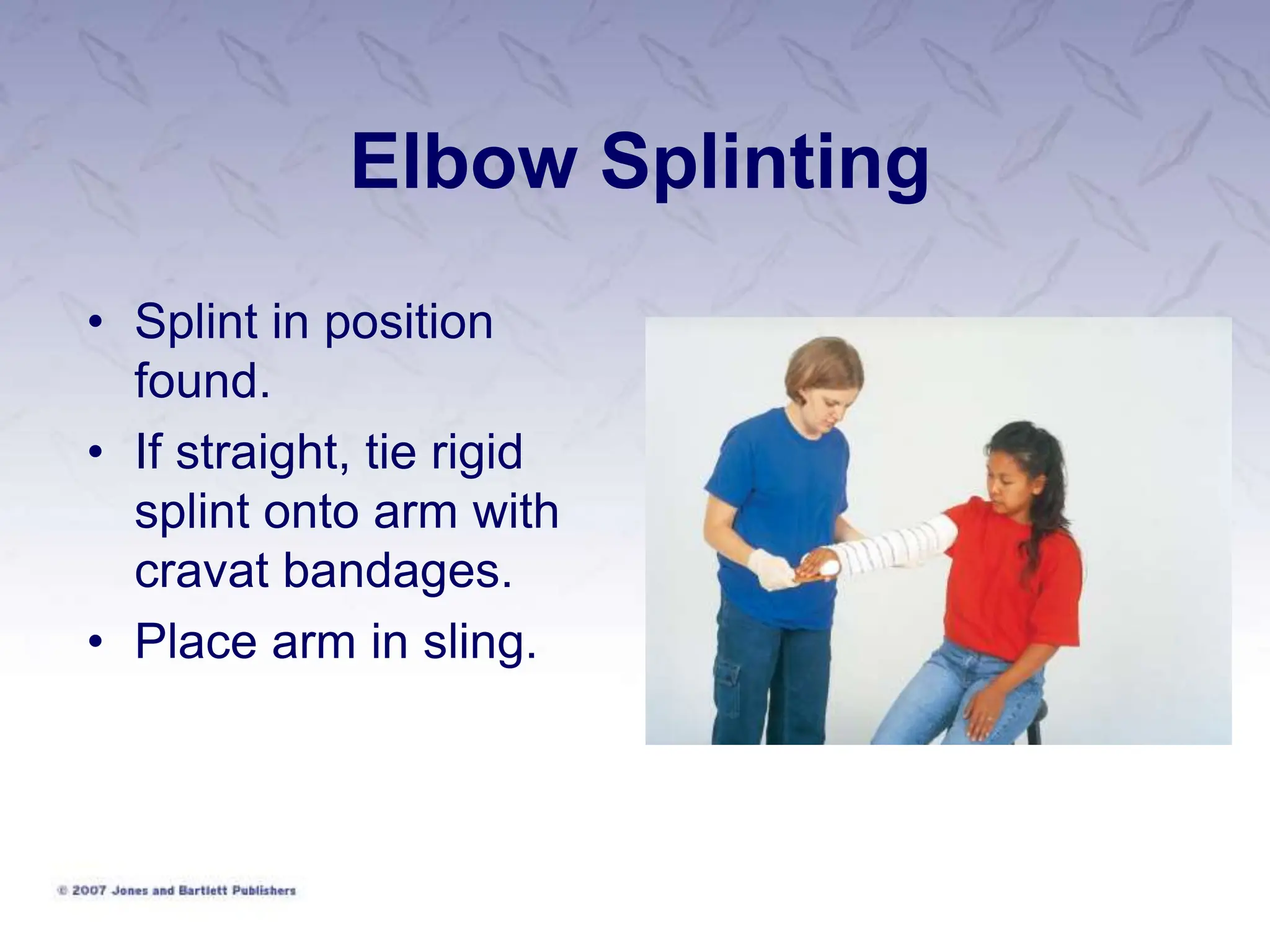 Splinting #6.ppt