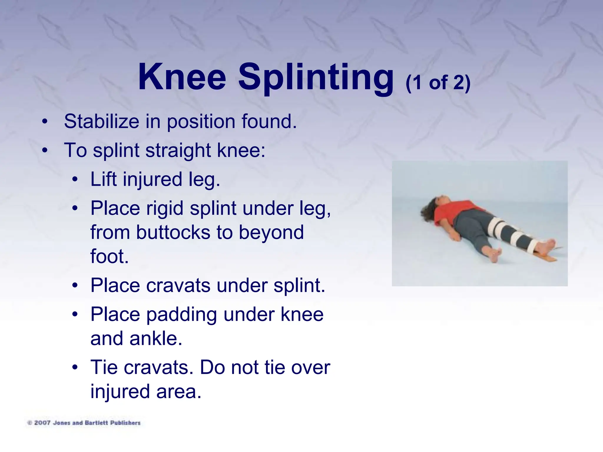 Splinting #6.ppt