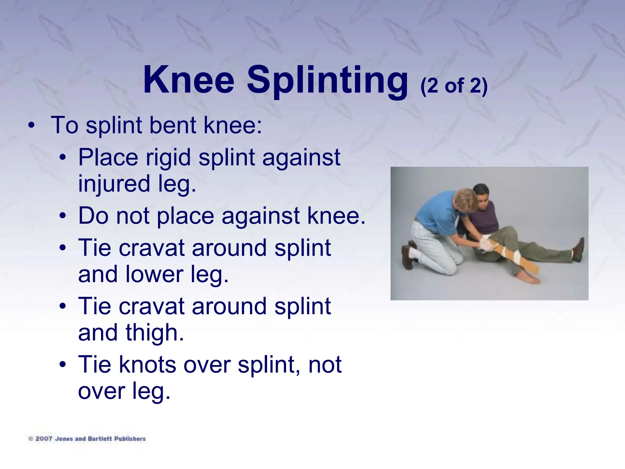 Splinting #6.ppt