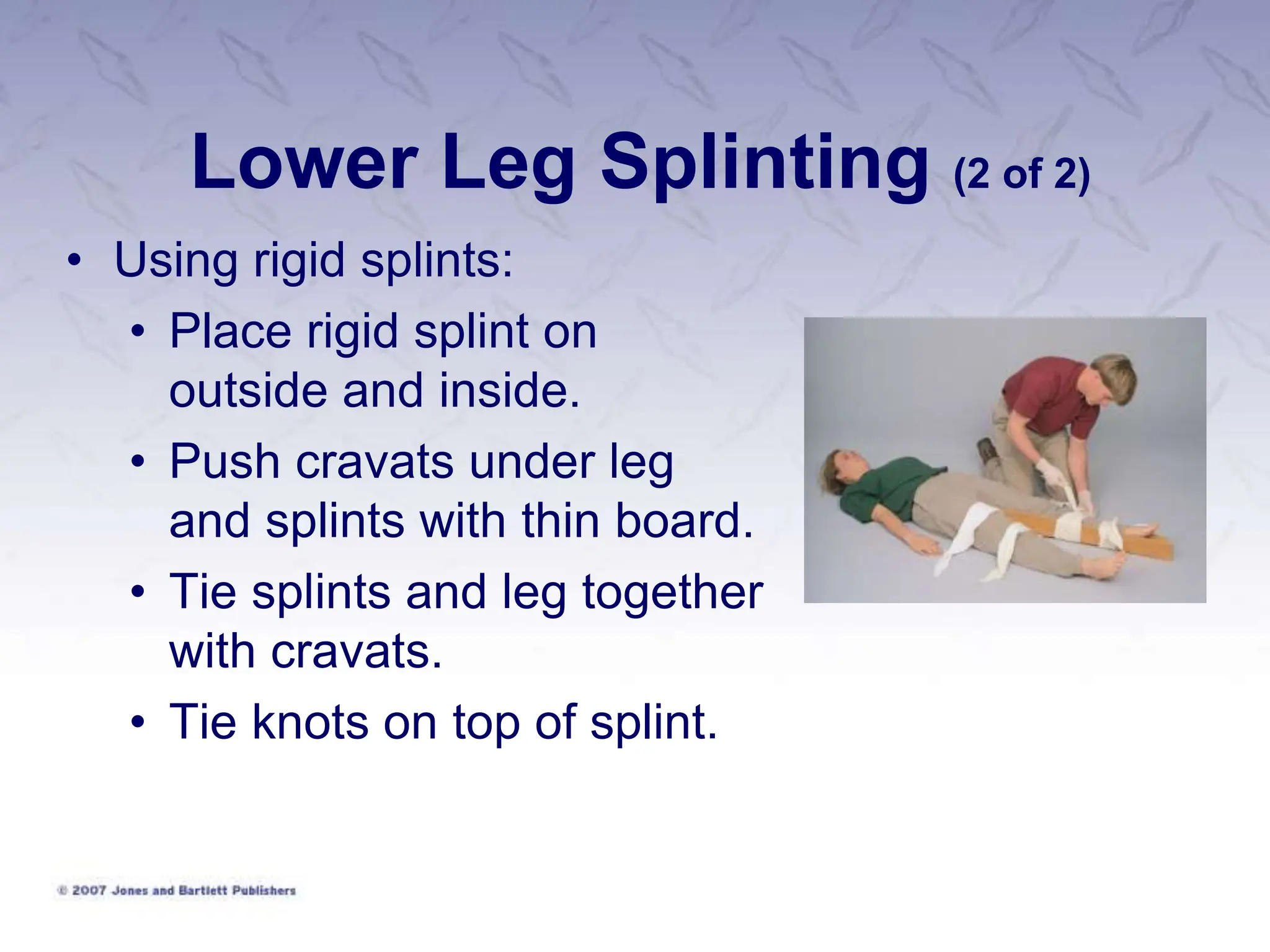 Splinting #6.ppt