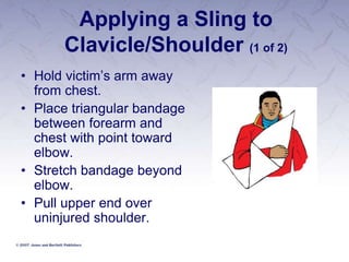 Splinting #6.ppt | First Aid | Injuries