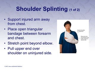 Splinting #6.ppt | First Aid | Injuries