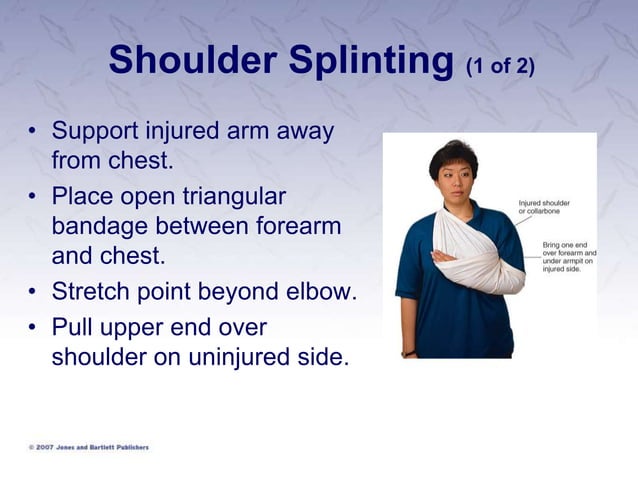 Splinting #6.ppt | First Aid | Injuries