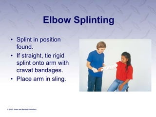 Splinting #6.ppt | First Aid | Injuries