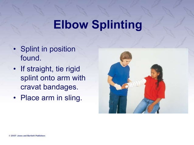 Splinting #6.ppt | First Aid | Injuries