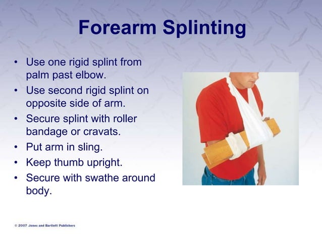 Splinting #6.ppt | First Aid | Injuries