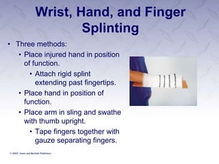 Splinting #6.ppt | First Aid | Injuries