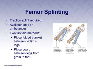 Splinting #6.ppt | First Aid | Injuries