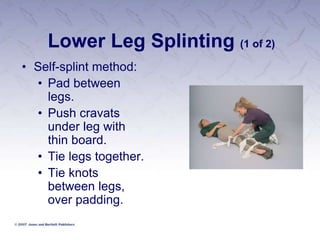 Splinting #6.ppt | First Aid | Injuries