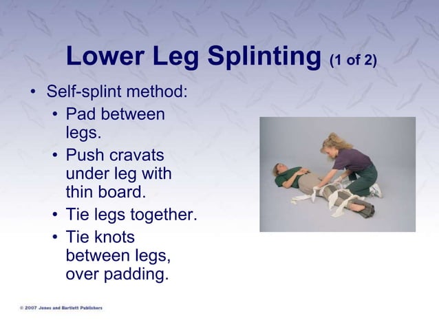 Splinting 6 Ppt