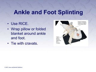 Splinting #6.ppt | First Aid | Injuries
