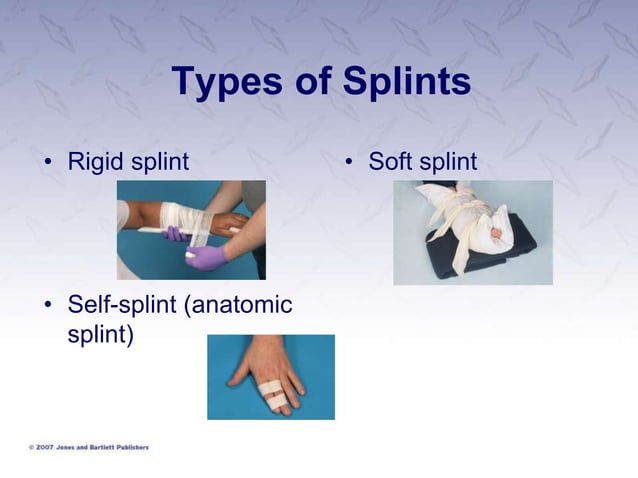 Splinting #6.ppt | First Aid | Injuries