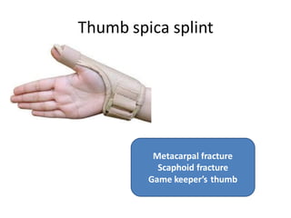 SPLINTING IN ORTHOPAEDICS.explains about various spilint | PPT