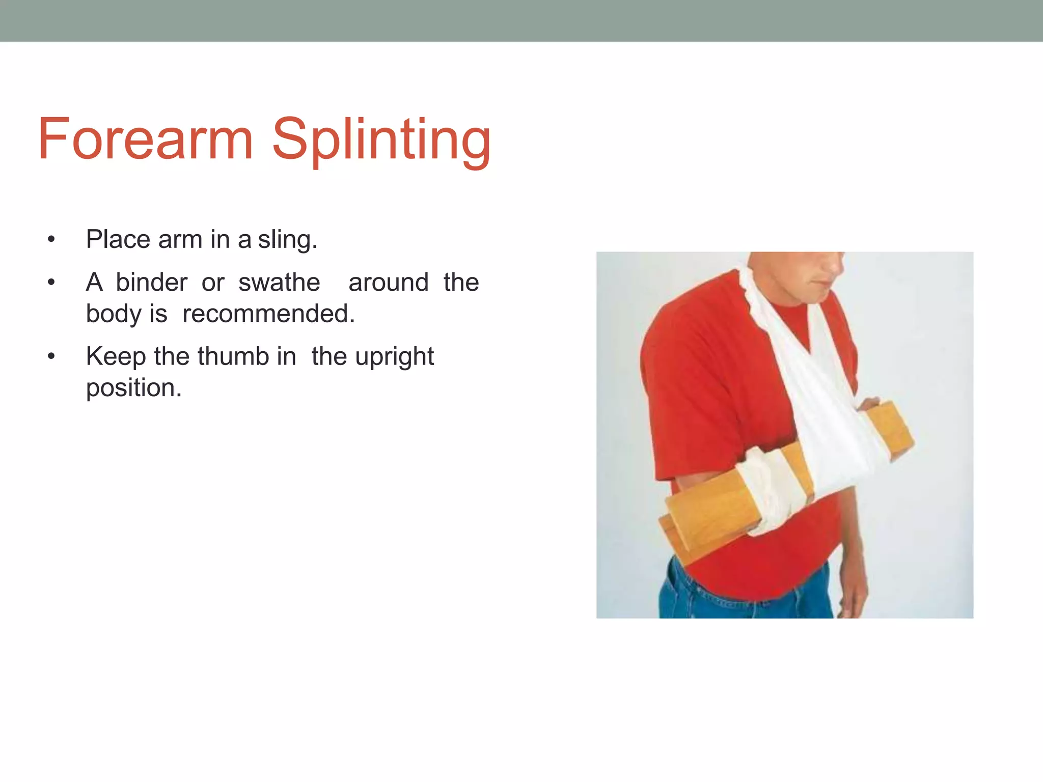 Splinting in sports | PPTX