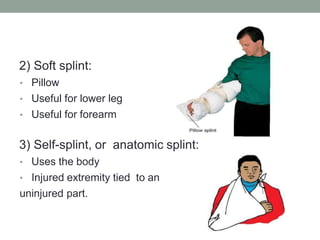 Splinting in sports | PPTX